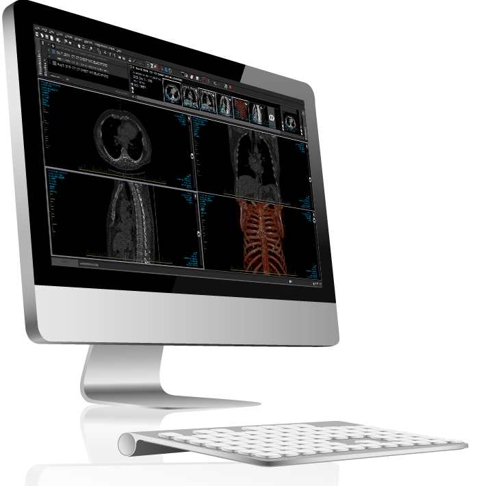 RSNA 2021: Intelerad Medical Systems Unveils Cloud-Native DR Solution ...
